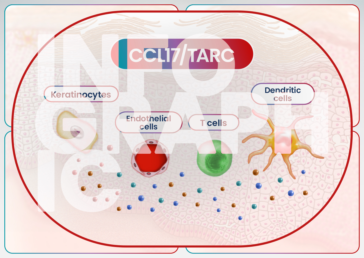 CCL17 (TARC): A Key Player and Biomarker in Atopic Dermatitis