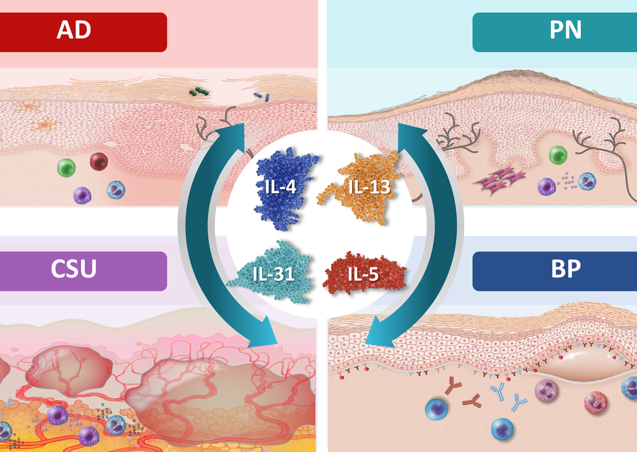 What Went Wrong? How Dysregulated Type 2 Immunity Contributes to AD, PN ...