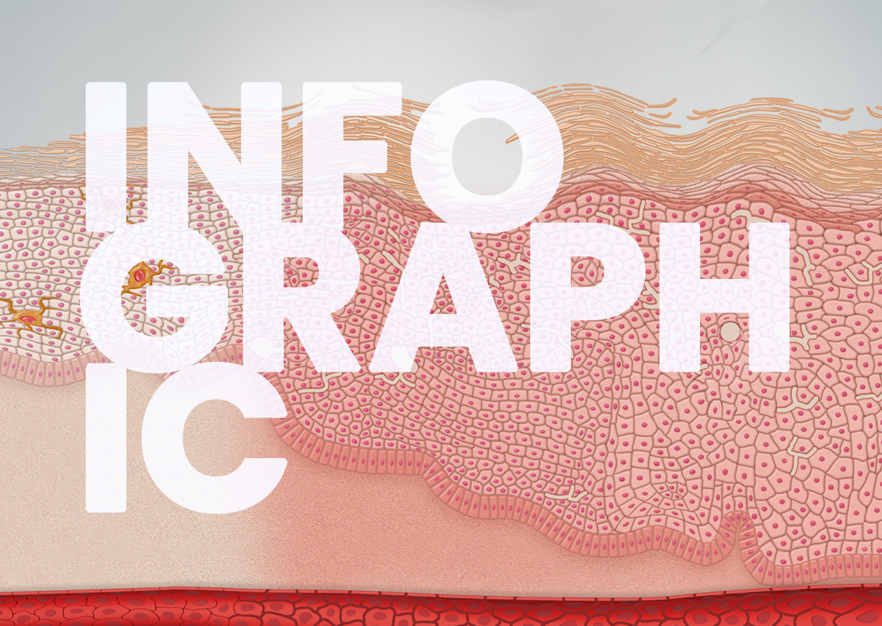 Skin Barrier Dysfunction and Increased Risk of Allergen Sensitization ...