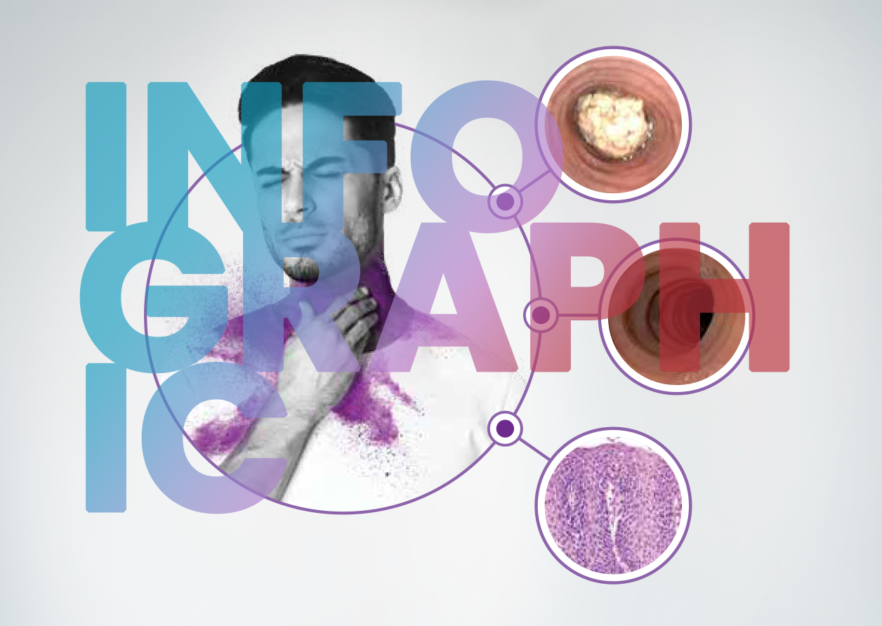Importance of Assessing Key Disease Domains in EoE Infographic
