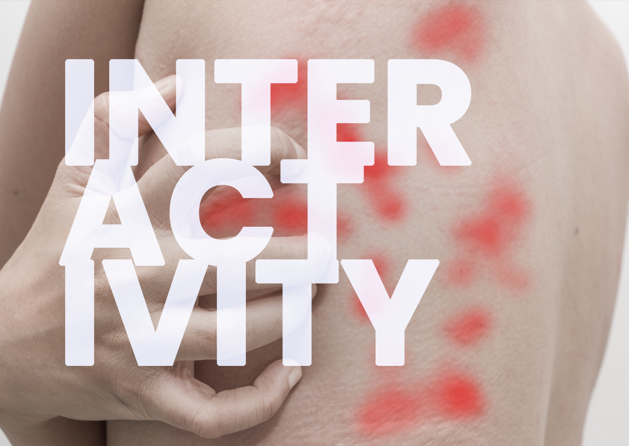 Chronic Spontaneous Urticaria (CSU) Interactive Patient Case